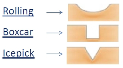 Acnelittekens | Skin Clinic Haaksbergen